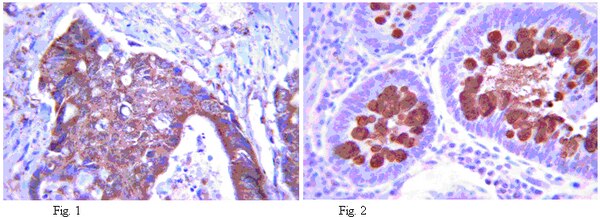 Anti-Frizzled-7 Antibody | 06-1063